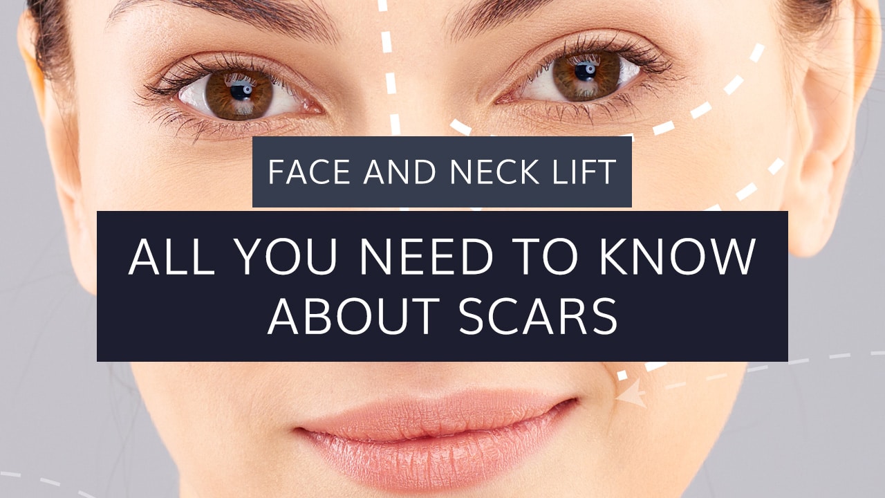 Face and Neck Lift: Everything You Need to Know About Scars | Jason ...